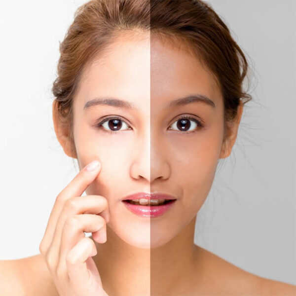 کیت روشن کننده پلاژن نئو برایت NeeBright اورجینال - سوپریم کالا